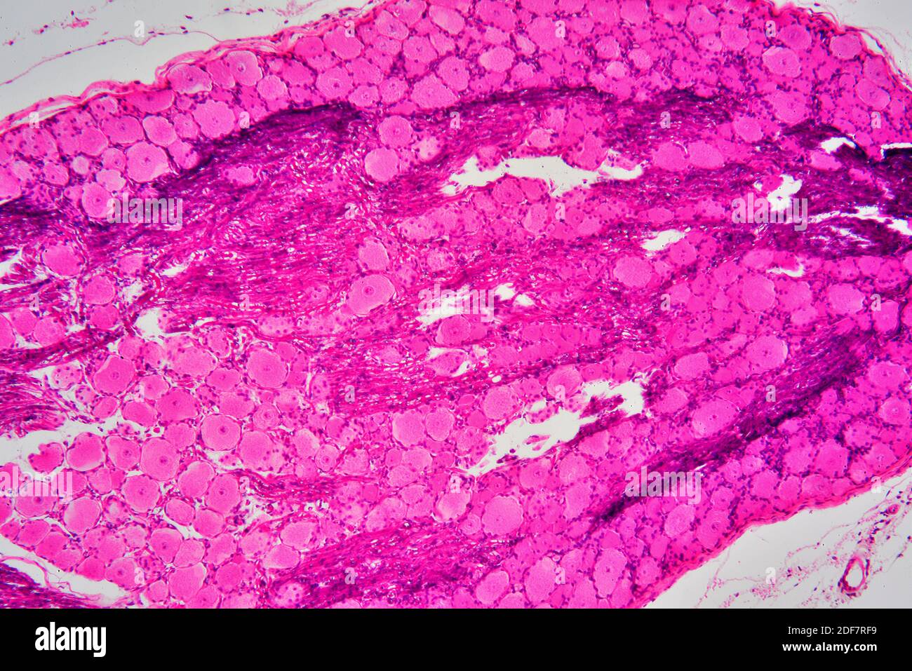 Autonomes ganglion -Fotos und -Bildmaterial in hoher Auflösung – Alamy