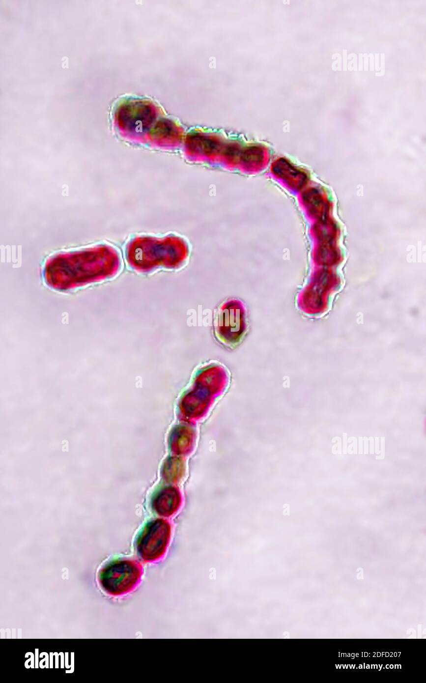 Streptococcus pyogenes gruppe a -Fotos und -Bildmaterial in hoher ...