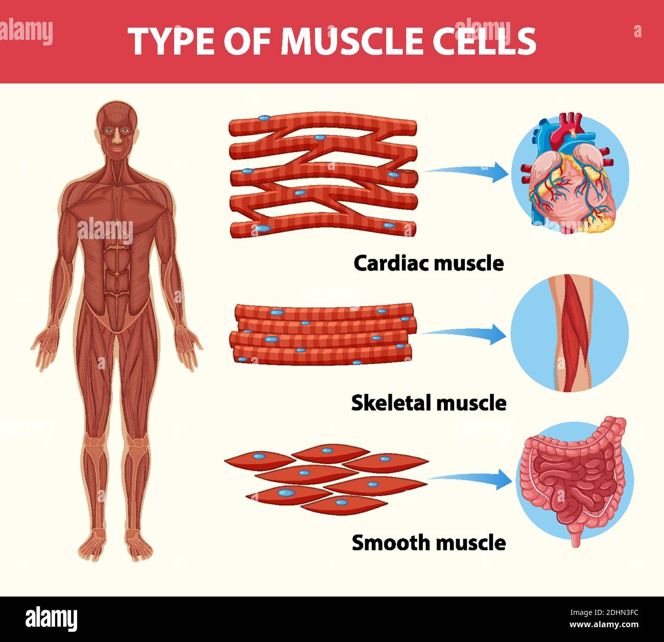 Art der Muskelzellen für die Gesundheitserziehung Infografik ...