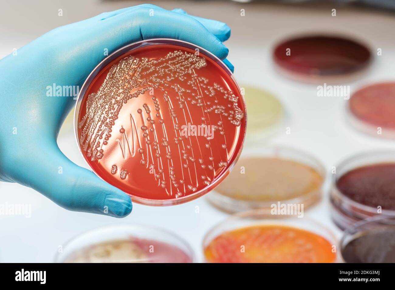 Blood Agar Stockfotos und -bilder Kaufen - Alamy