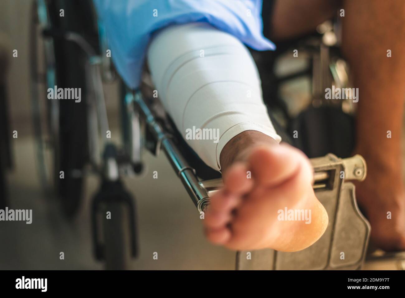 Bein Gebrochen Mann Mit Gipsfuss Stockfotos und -bilder Kaufen - Alamy
