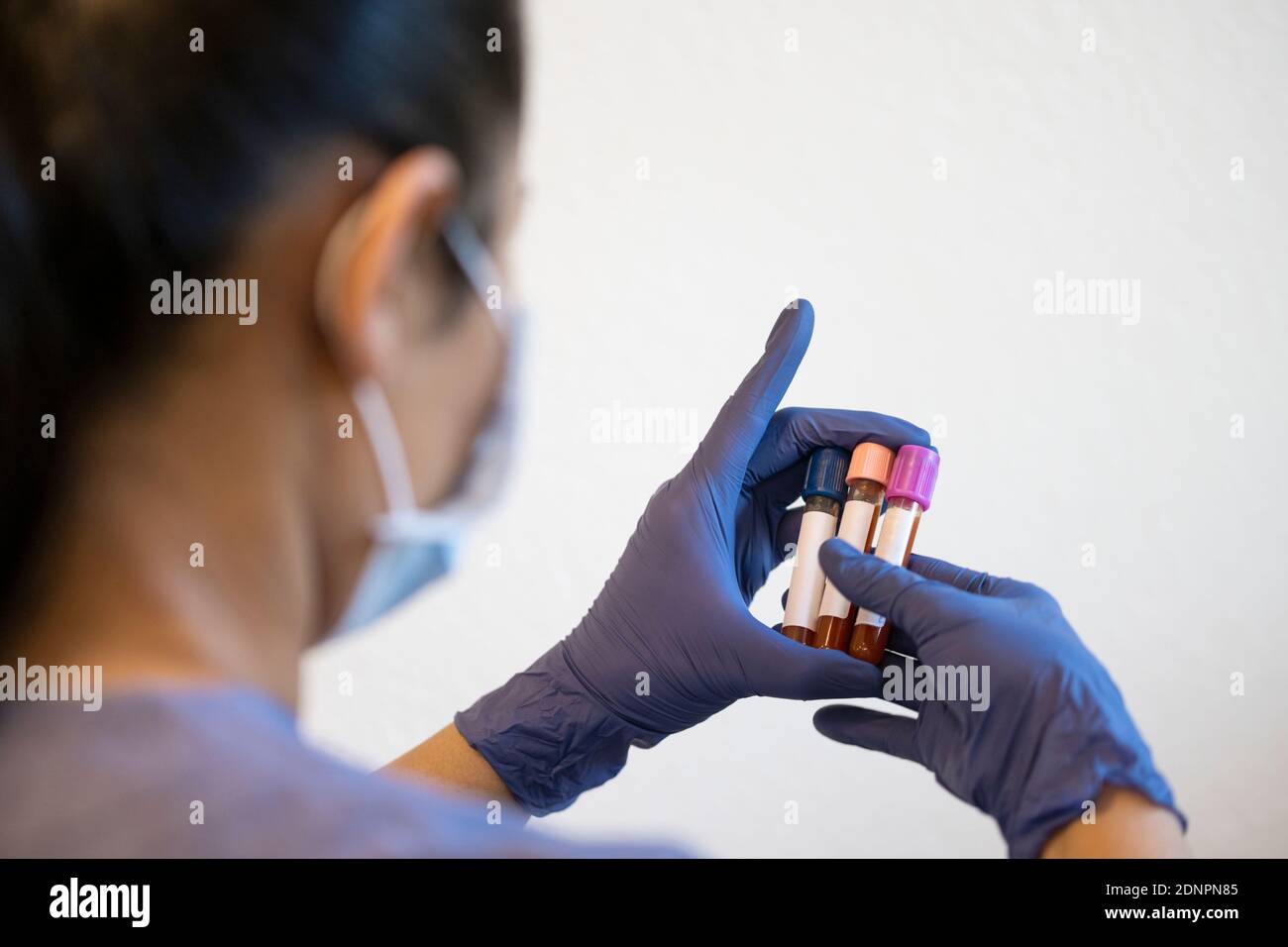 Medizinische proben -Fotos und -Bildmaterial in hoher Auflösung – Alamy