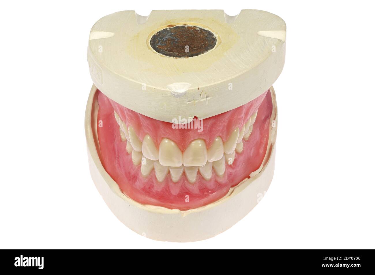 Implantat model -Fotos und -Bildmaterial in hoher Auflösung – Alamy