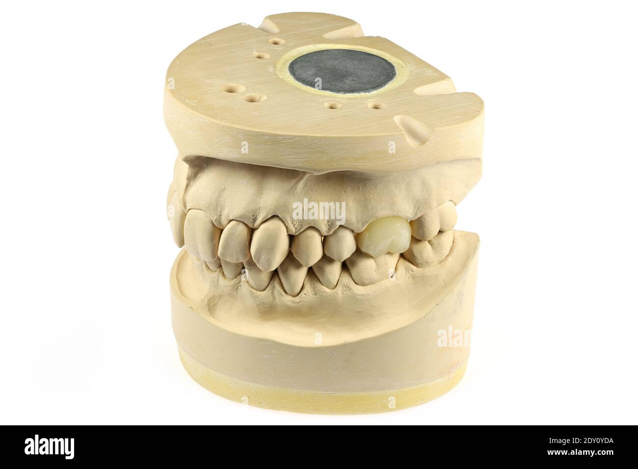 Implantat model -Fotos und -Bildmaterial in hoher Auflösung – Alamy