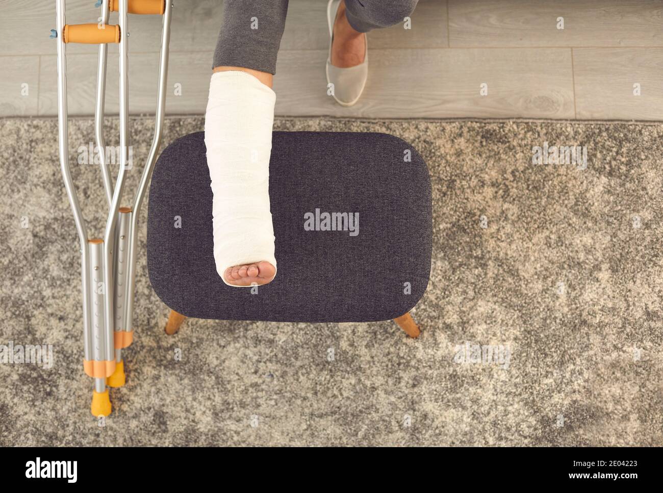 Fuß gebrochen gips -Fotos und -Bildmaterial in hoher Auflösung – Alamy