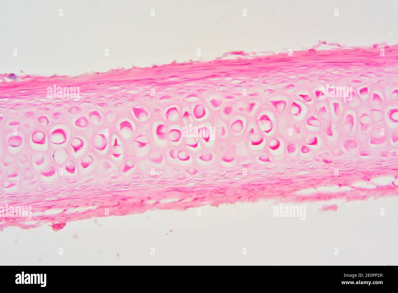 Human bone -Fotos und -Bildmaterial in hoher Auflösung – Alamy