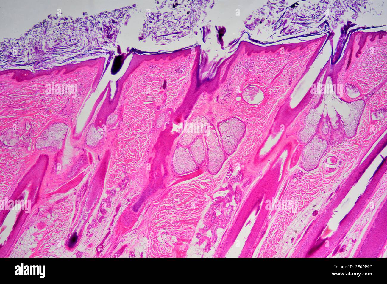 Skin sebaceous gland stain -Fotos und -Bildmaterial in hoher Auflösung ...