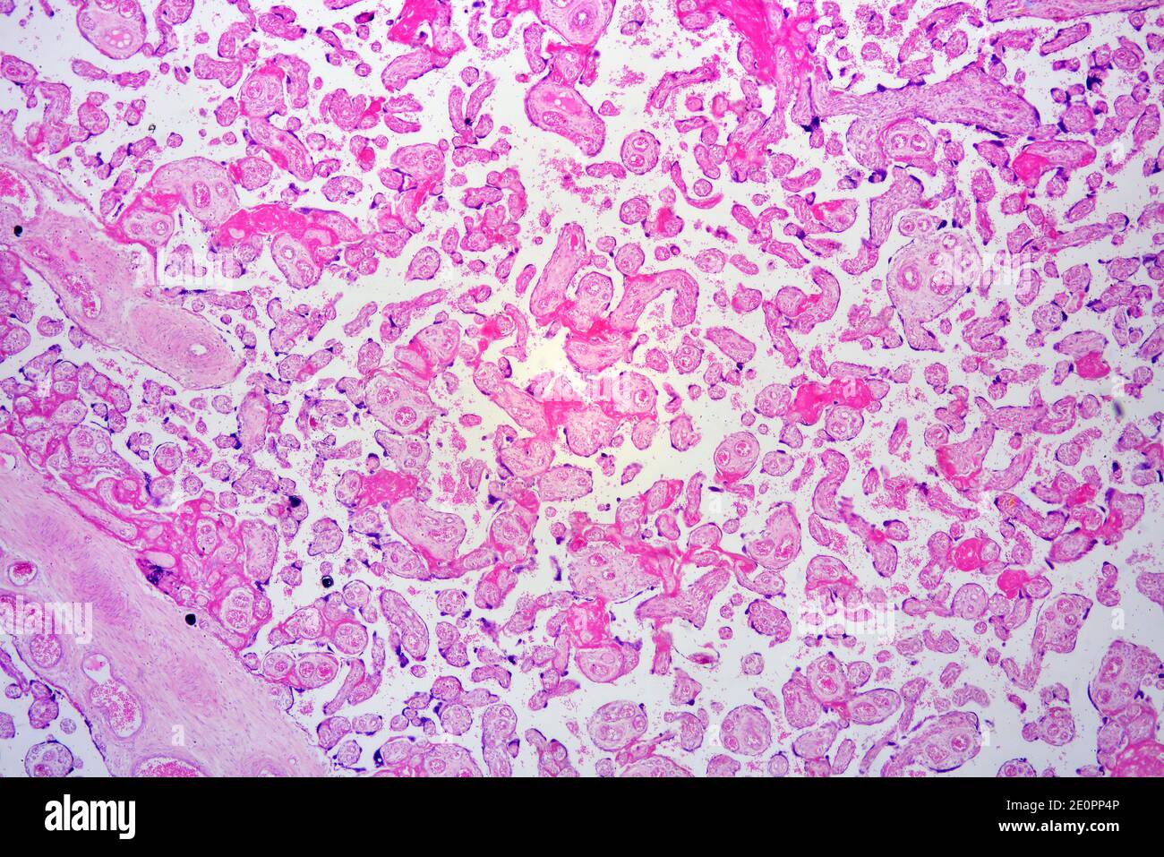 Chorion Placenta Stockfotos und -bilder Kaufen - Alamy