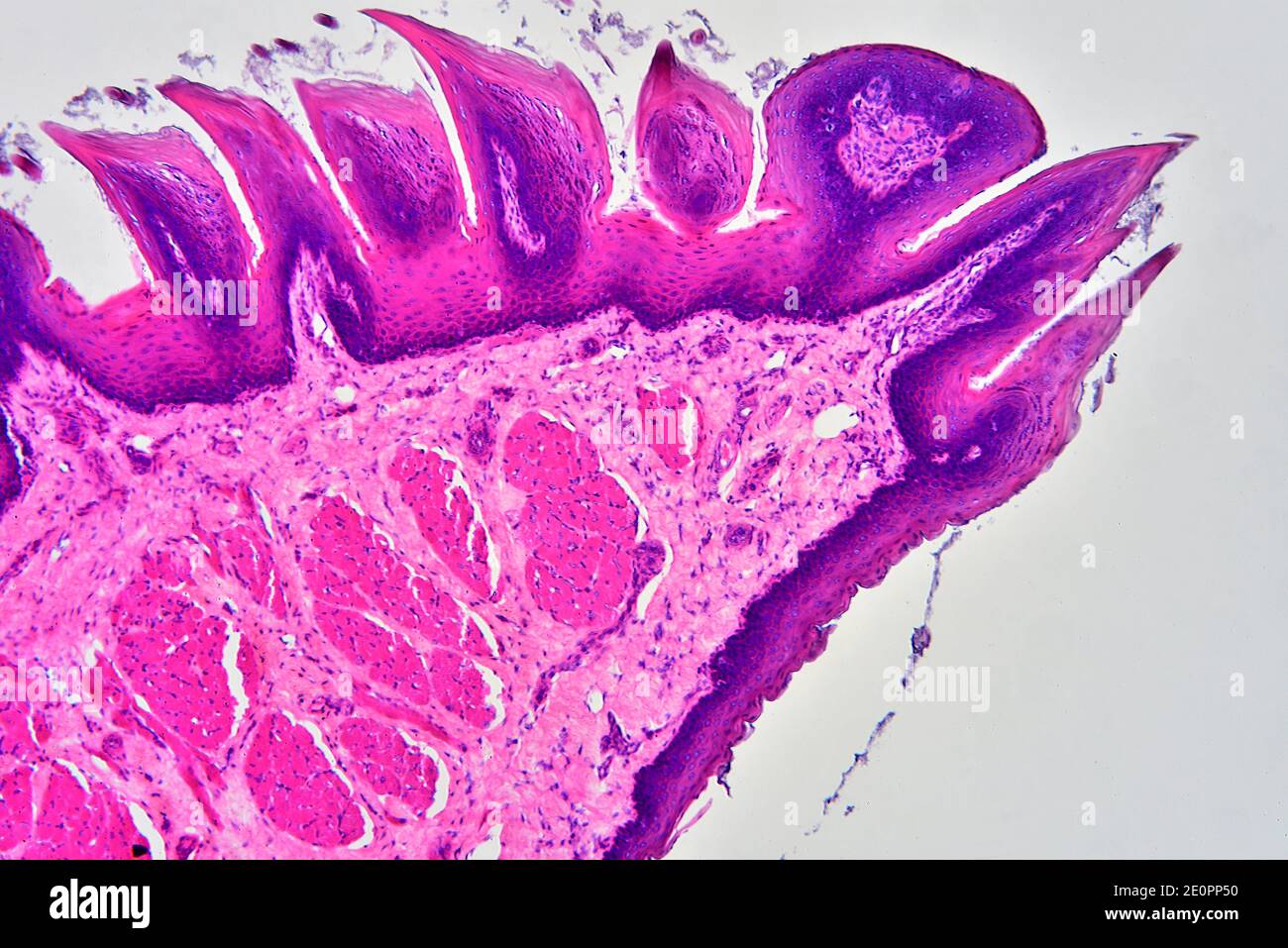 Tongue Papillae Stockfotos und -bilder Kaufen - Alamy