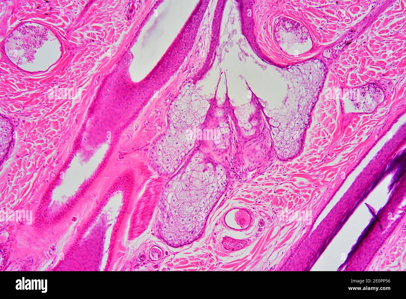 Skin sebaceous gland micrograph -Fotos und -Bildmaterial in hoher ...