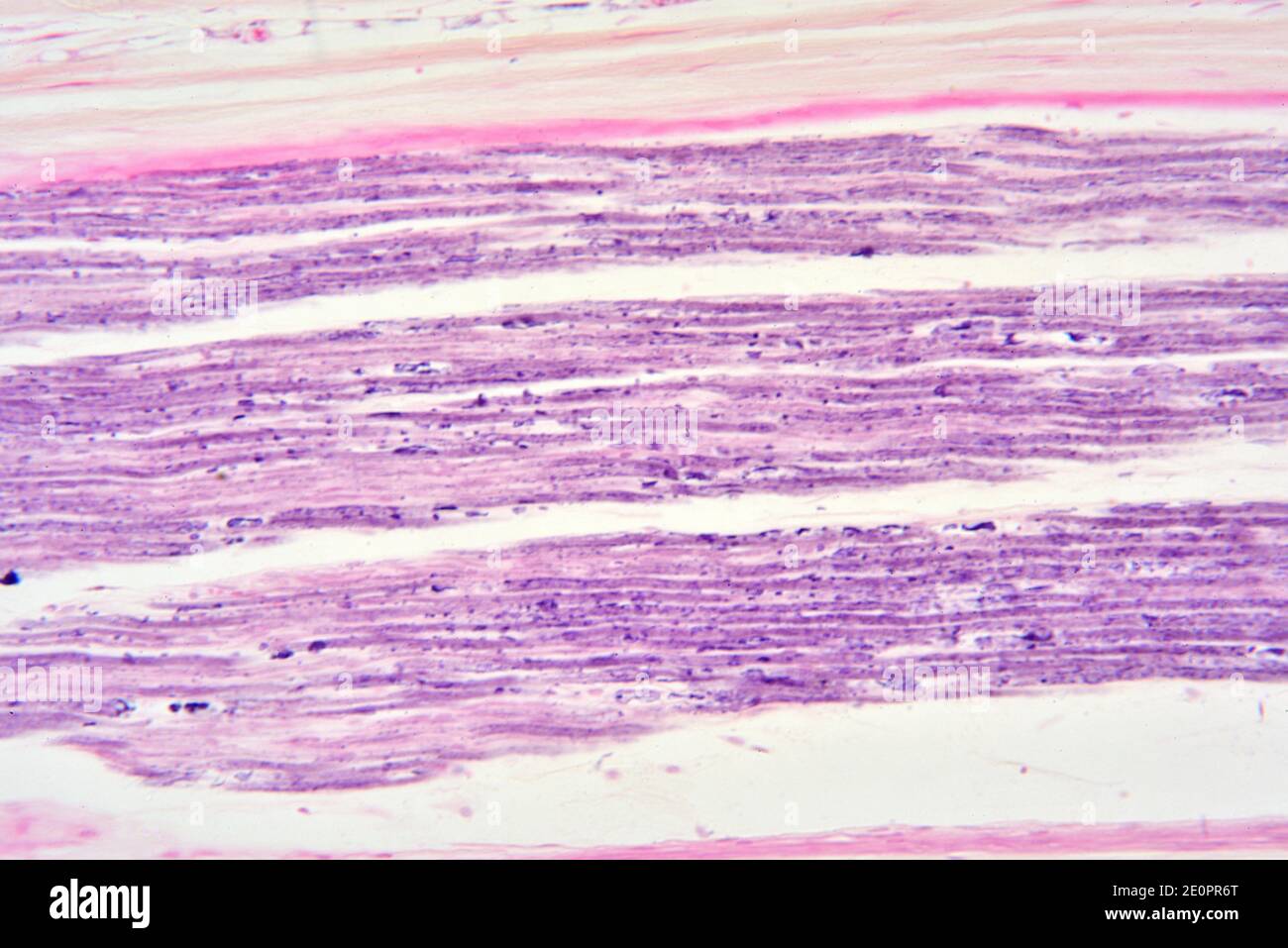 Sciatic nerve -Fotos und -Bildmaterial in hoher Auflösung – Alamy