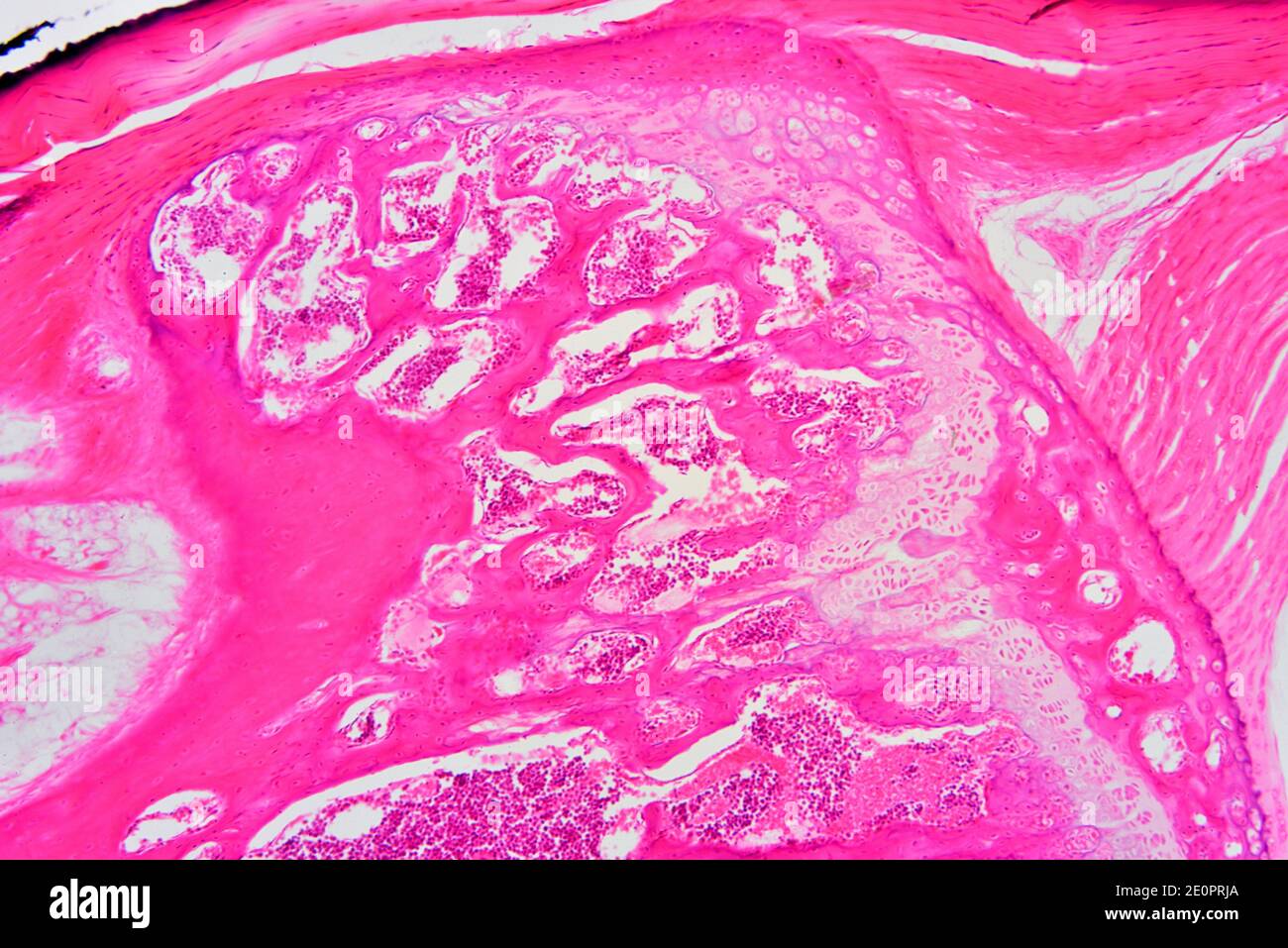 Médula ósea -Fotos und -Bildmaterial in hoher Auflösung – Alamy