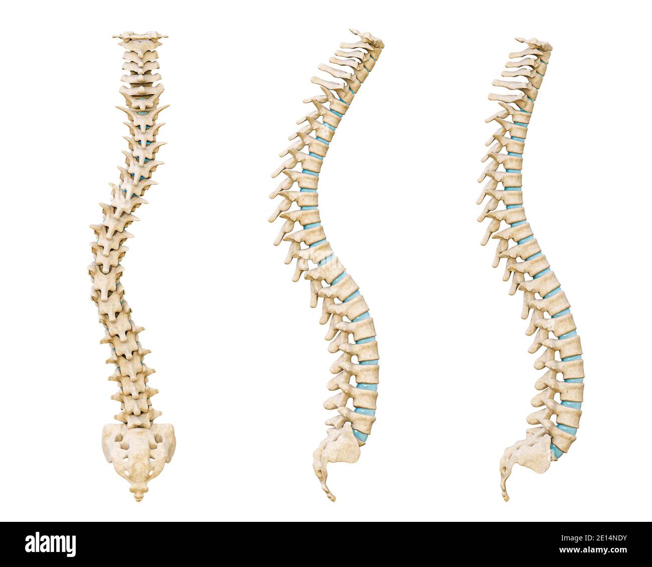Lordose Der Wirbelsäule