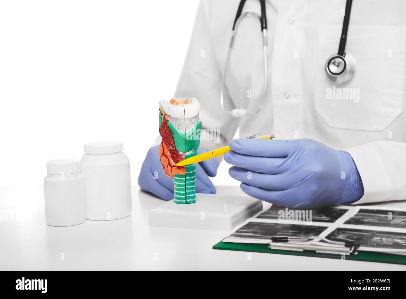 Struma behandlung -Fotos und -Bildmaterial in hoher Auflösung – Alamy