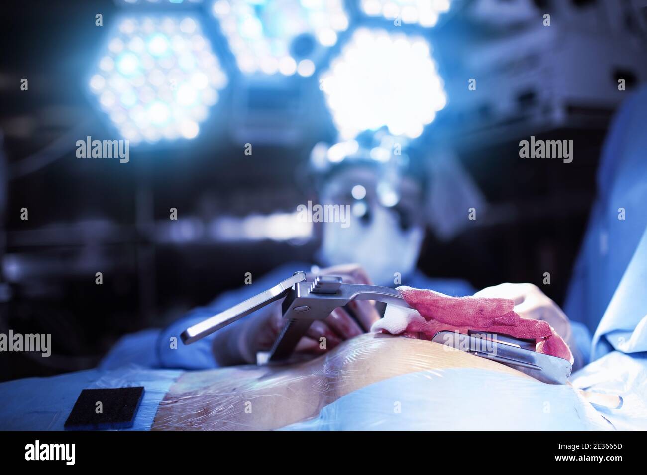 Surgeon in operation theatre -Fotos und -Bildmaterial in hoher ...