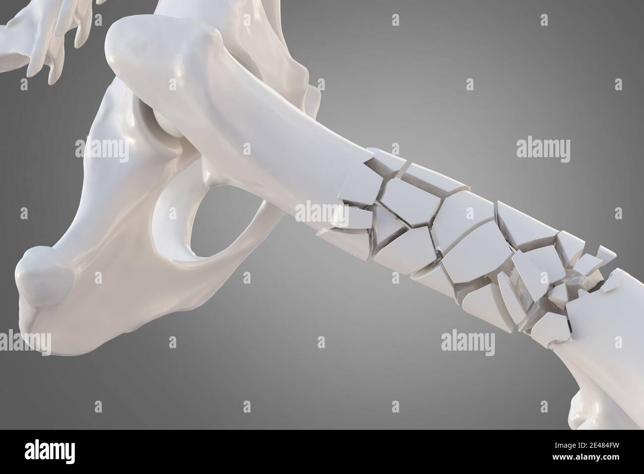 Gebrochener Hund Oberschenkelknochen mit sichtbaren anderen Knochen. 3D-Abbildung des Eckzahn ...