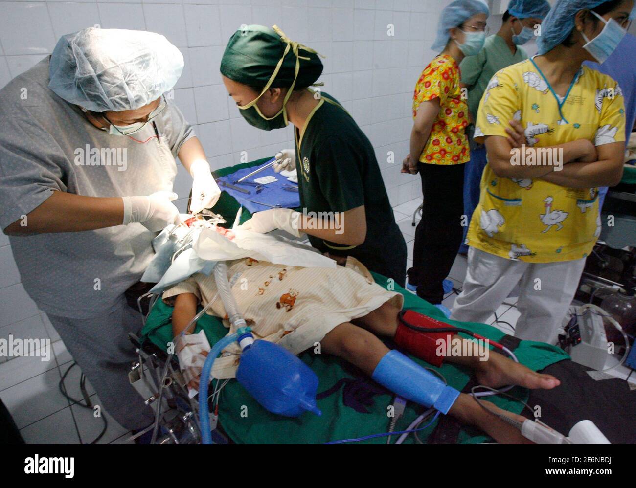 Congenital cleft palate -Fotos und -Bildmaterial in hoher Auflösung – Alamy