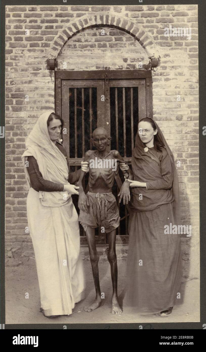 Opfer hungersnot -Fotos und -Bildmaterial in hoher Auflösung – Alamy