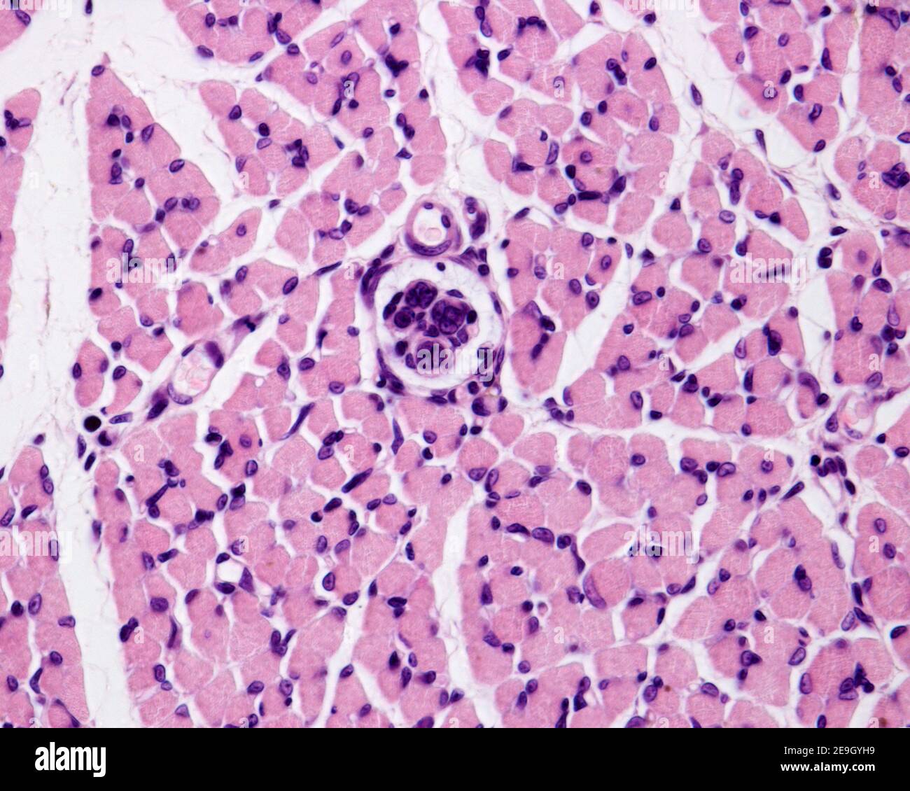 Querschnittete Muskelspindel, befindet sich in einem jungen Muskel. Es ...