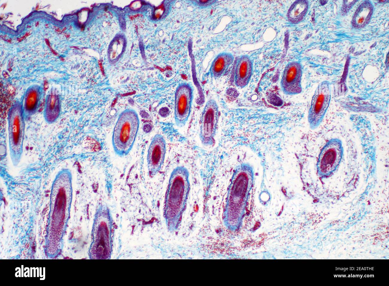 Aufbau der haut -Fotos und -Bildmaterial in hoher Auflösung – Alamy