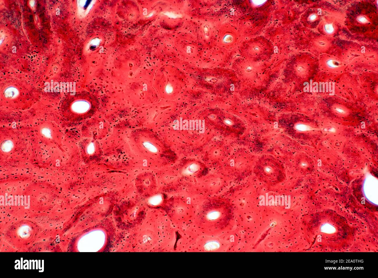 Bone Light Micrograph Stockfotos und -bilder Kaufen - Alamy