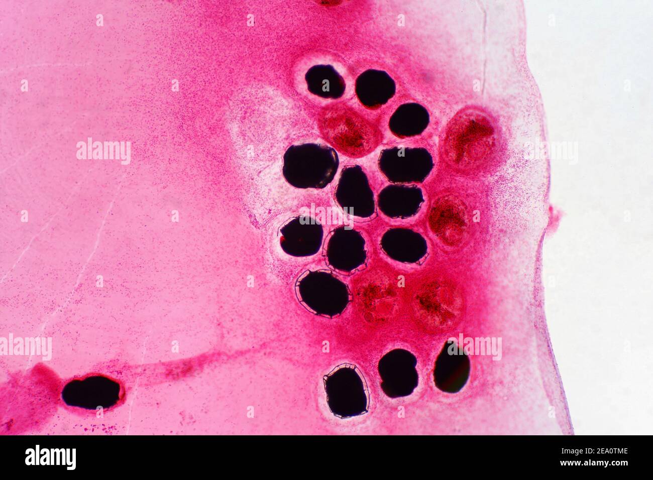 Parasiten wurm fisch -Fotos und -Bildmaterial in hoher Auflösung – Alamy