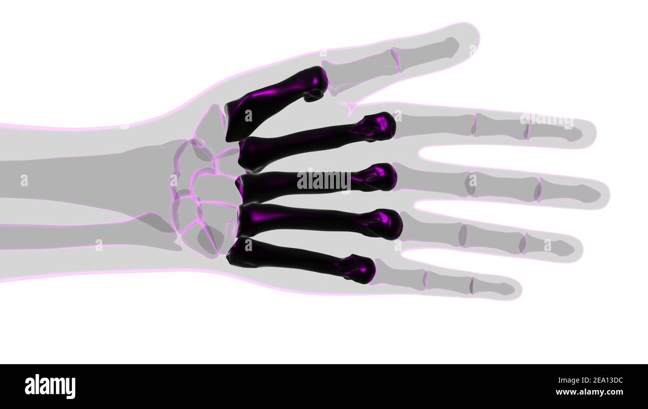Menschliche Skelett Hand Phalanges Knochen Anatomie für medizinisches ...