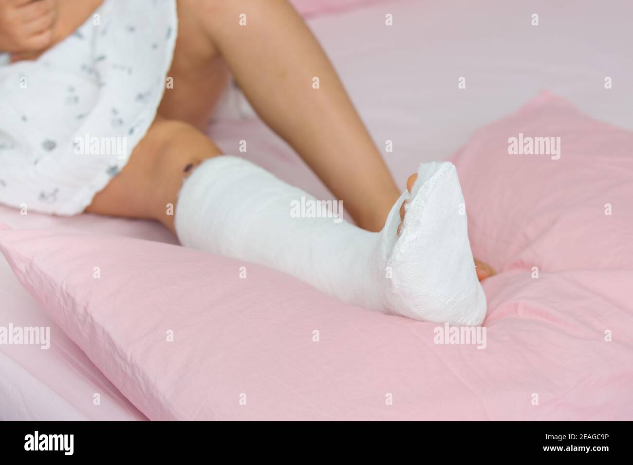 Bein gips mädchen -Fotos und -Bildmaterial in hoher Auflösung – Alamy