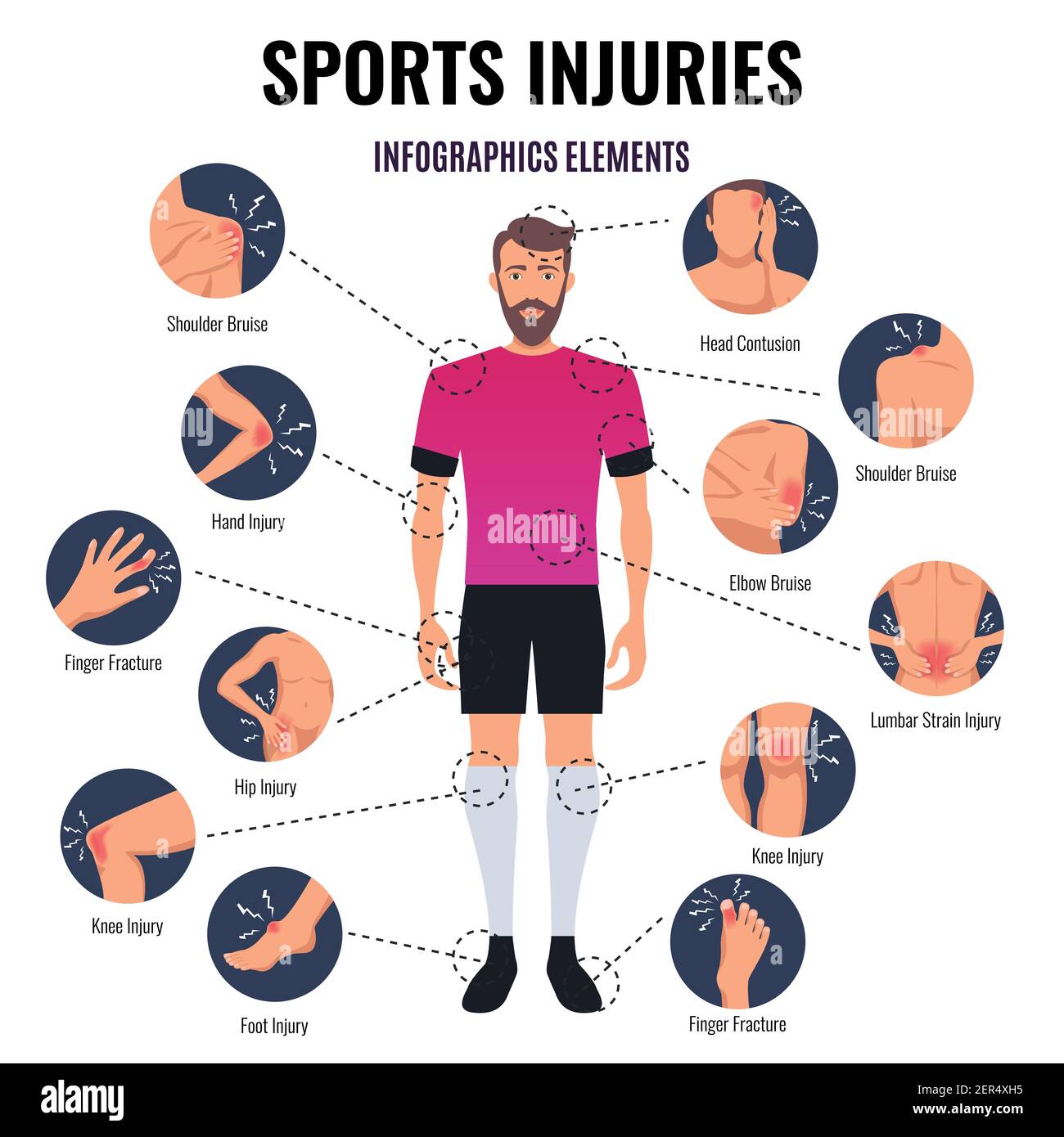 Allgemeine Sportverletzungen flache Runde Infografik Elemente Chart mit ...