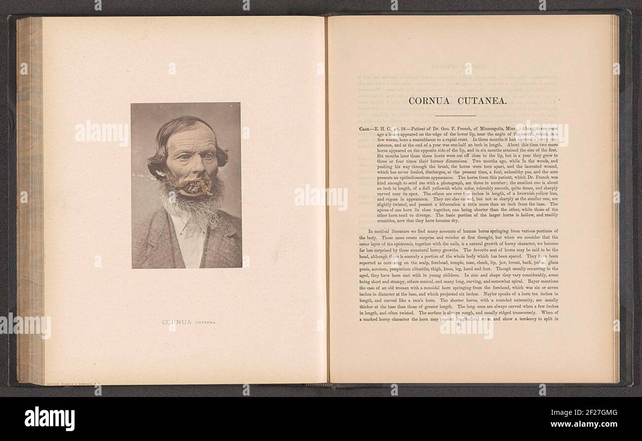 Pelle cutanea -Fotos und -Bildmaterial in hoher Auflösung – Alamy