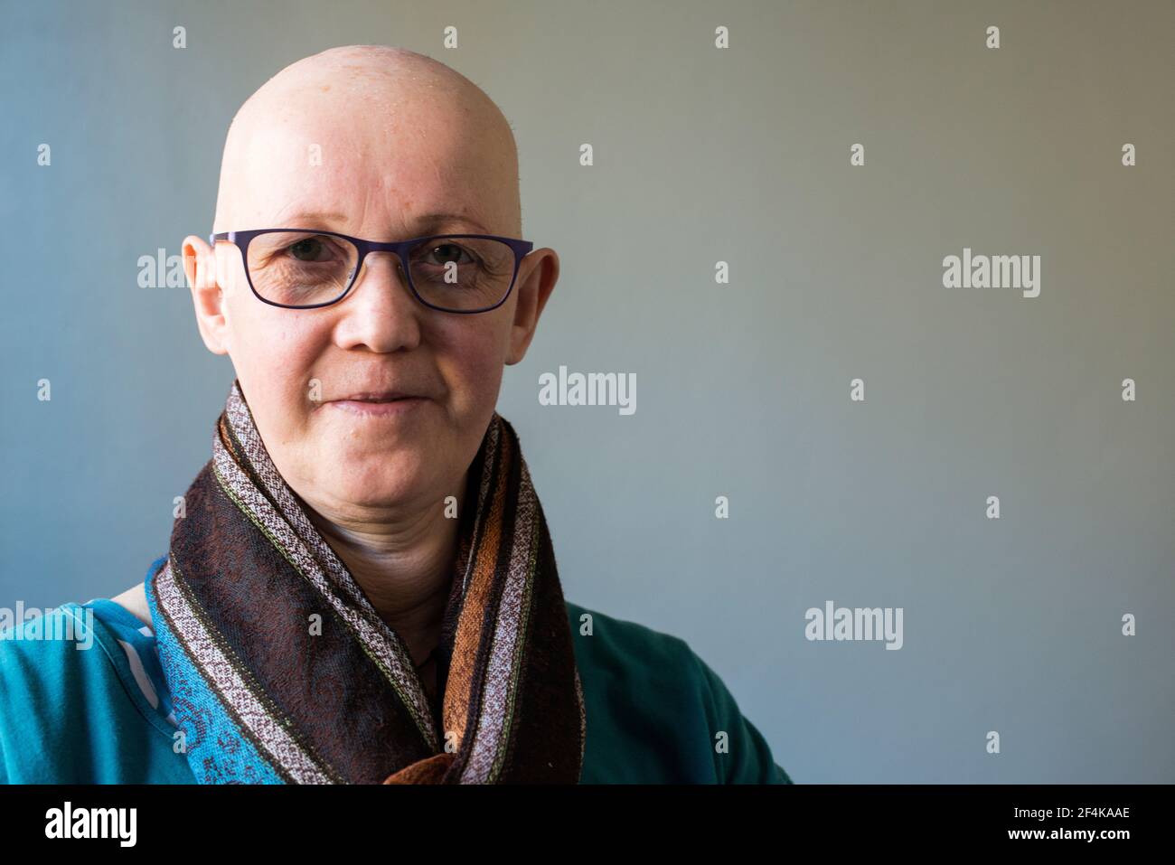 Eec syndroom -Fotos und -Bildmaterial in hoher Auflösung – Alamy