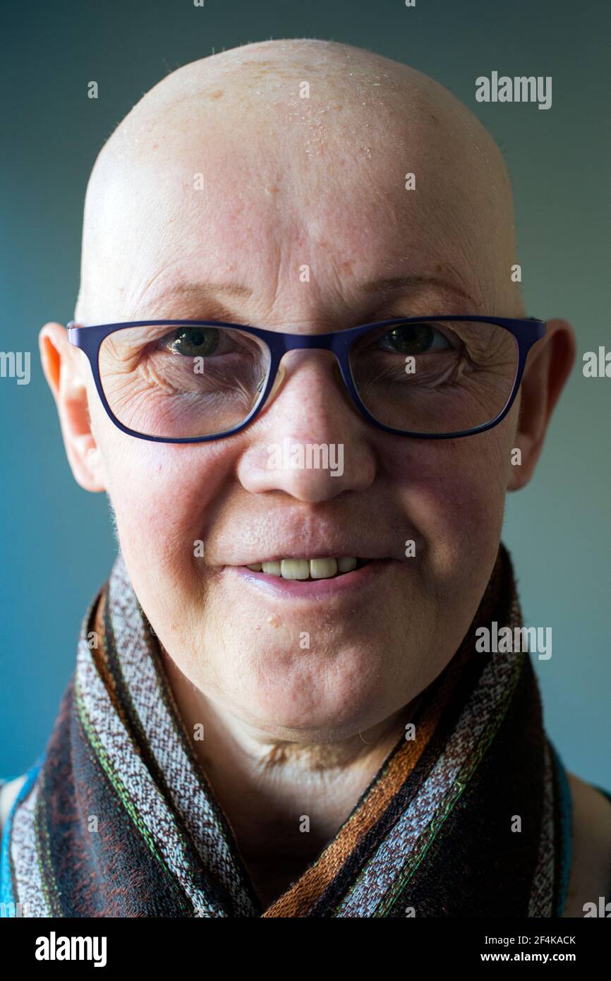 Aec syndroom -Fotos und -Bildmaterial in hoher Auflösung – Alamy