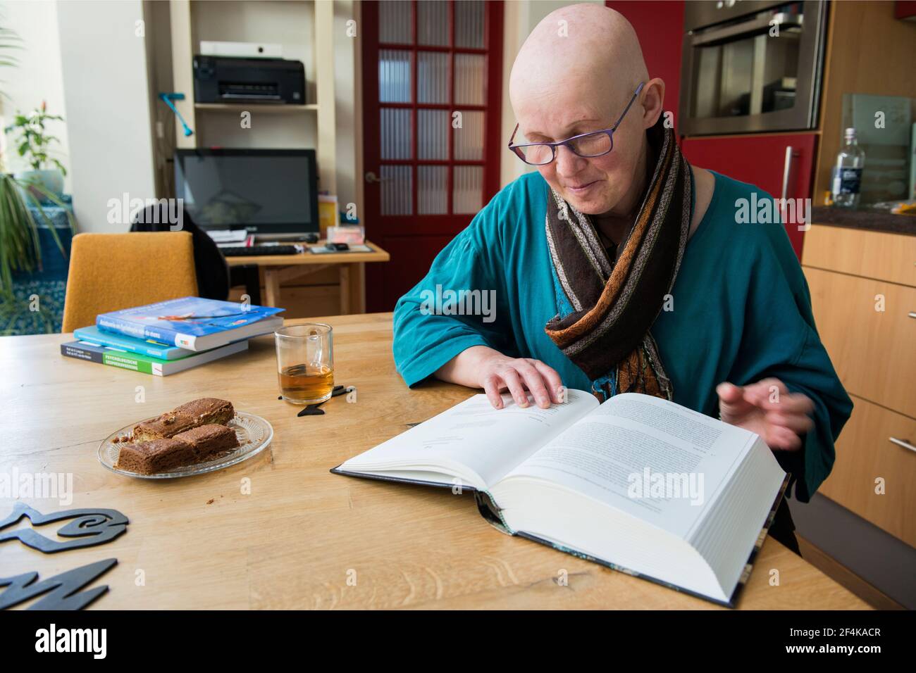 Eec syndroom -Fotos und -Bildmaterial in hoher Auflösung – Alamy