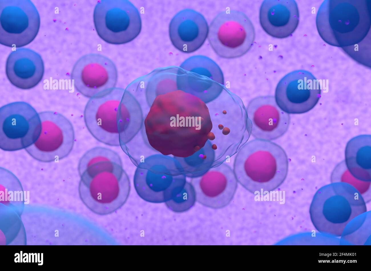 Multiple myeloma diagnosis -Fotos und -Bildmaterial in hoher Auflösung ...