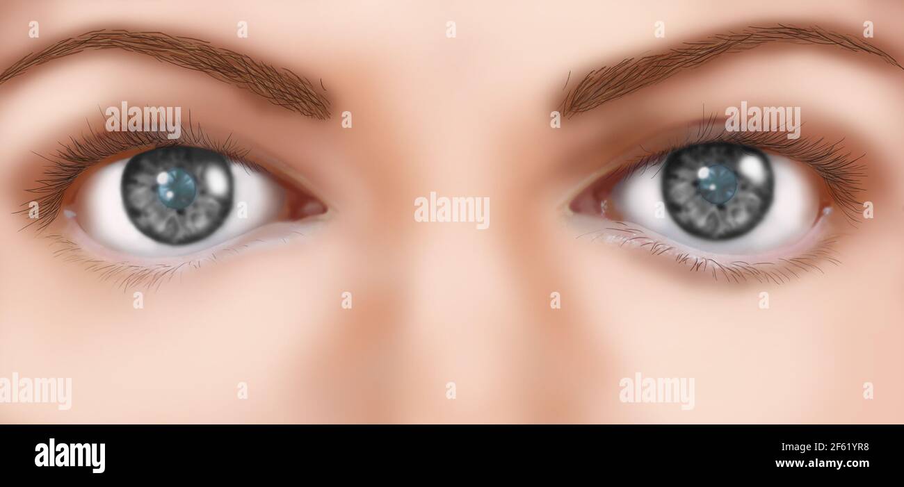 Katarakte in den augen -Fotos und -Bildmaterial in hoher Auflösung – Alamy