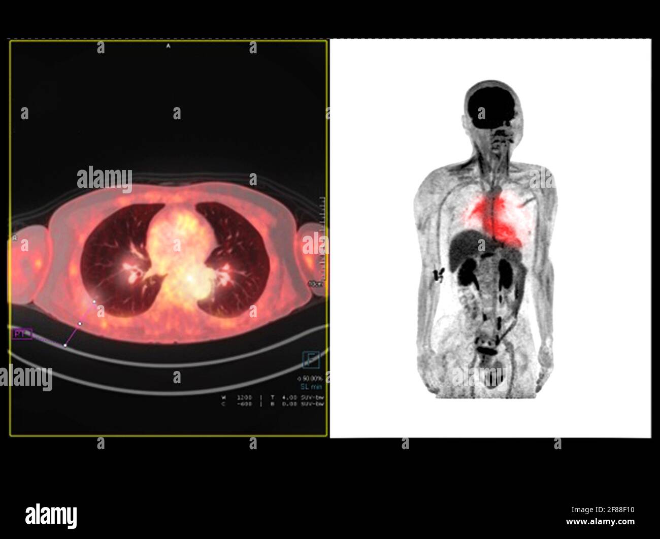 Pet Ct Scanner Stockfotos und -bilder Kaufen - Alamy