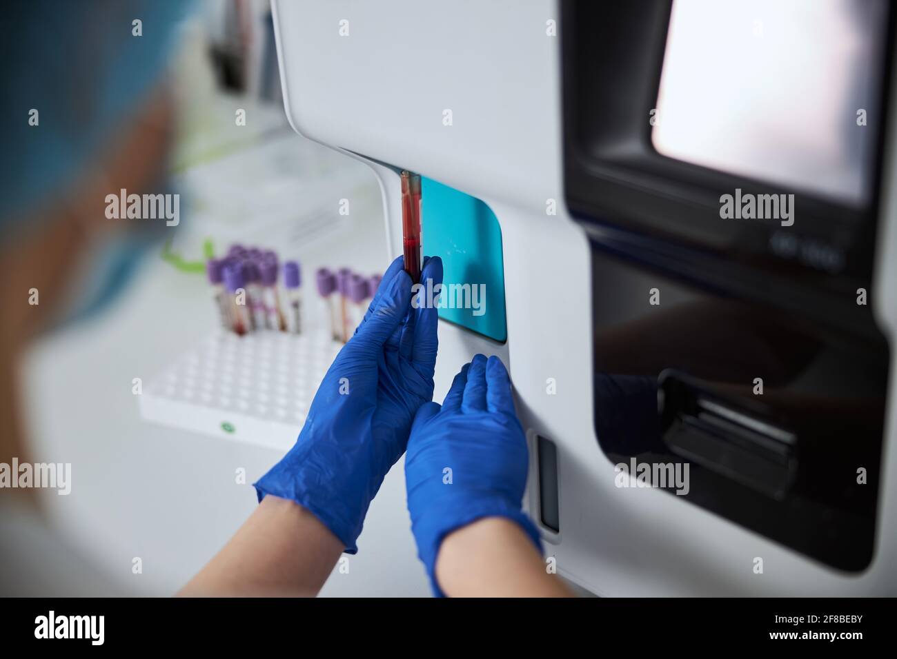 Clinical analyzer -Fotos und -Bildmaterial in hoher Auflösung – Alamy