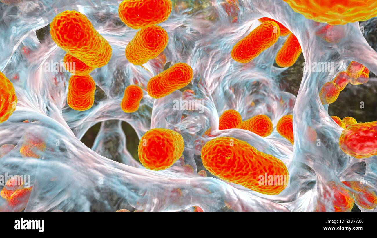 Acinetobacter baumannii Bakterien, Abbildung Stockfotografie - Alamy Acinetobacter baumannii Bakterien, Abbildung Stockfotografie - Alamy