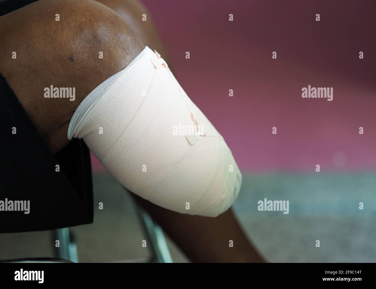 Beinamputation unterhalb des knies -Fotos und -Bildmaterial in hoher ...