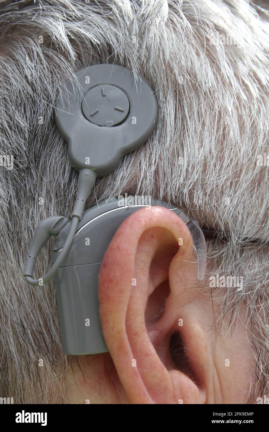 Hinter Dem Ohr Stockfotos und -bilder Kaufen - Alamy