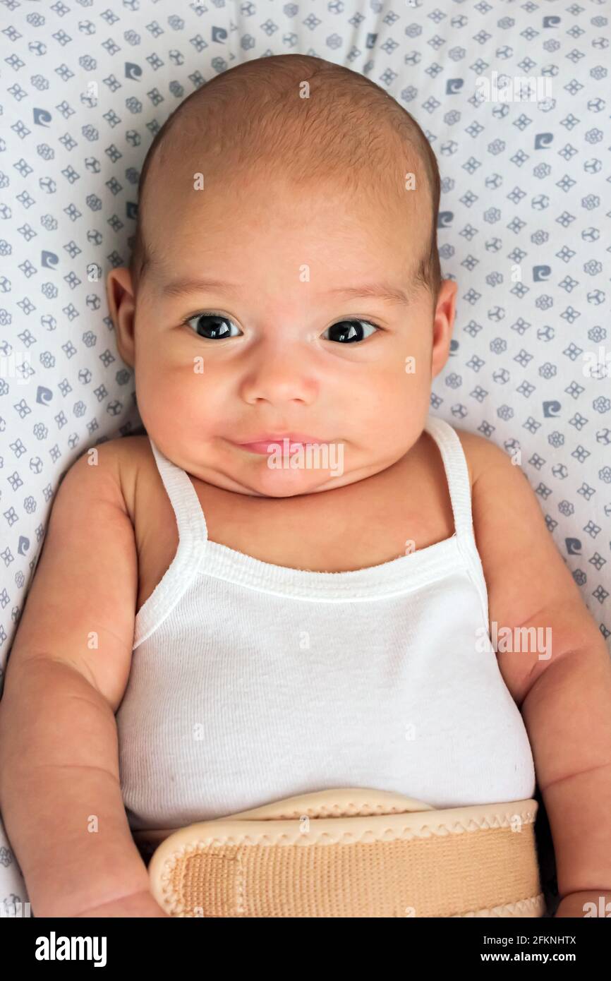 Hernie bei babys -Fotos und -Bildmaterial in hoher Auflösung – Alamy