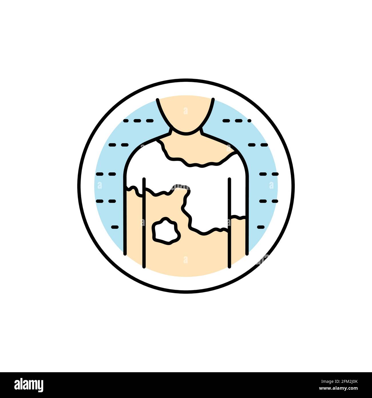 Symbol für die Vitiligo-Farblinie. Dermatologische Erkrankung ...