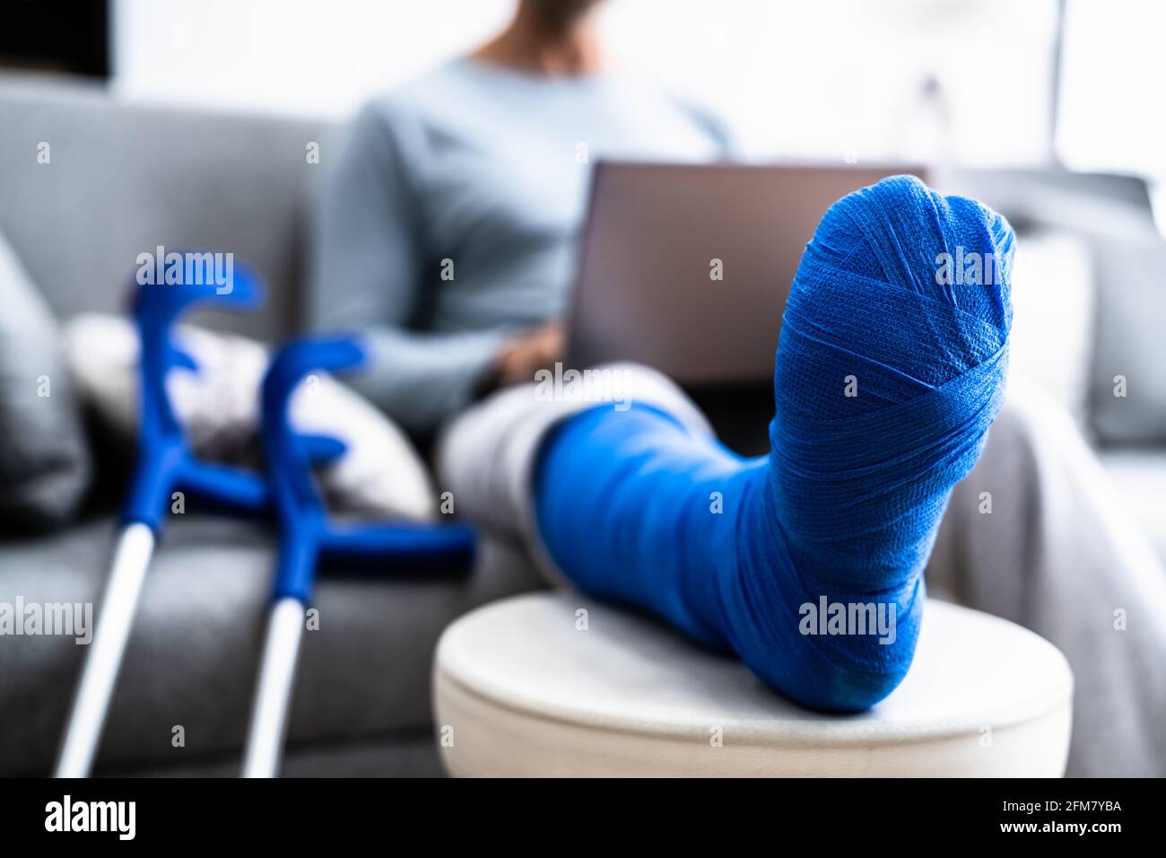 Gipsverband Bein Gebrochen Mann Stockfotos und -bilder Kaufen - Alamy