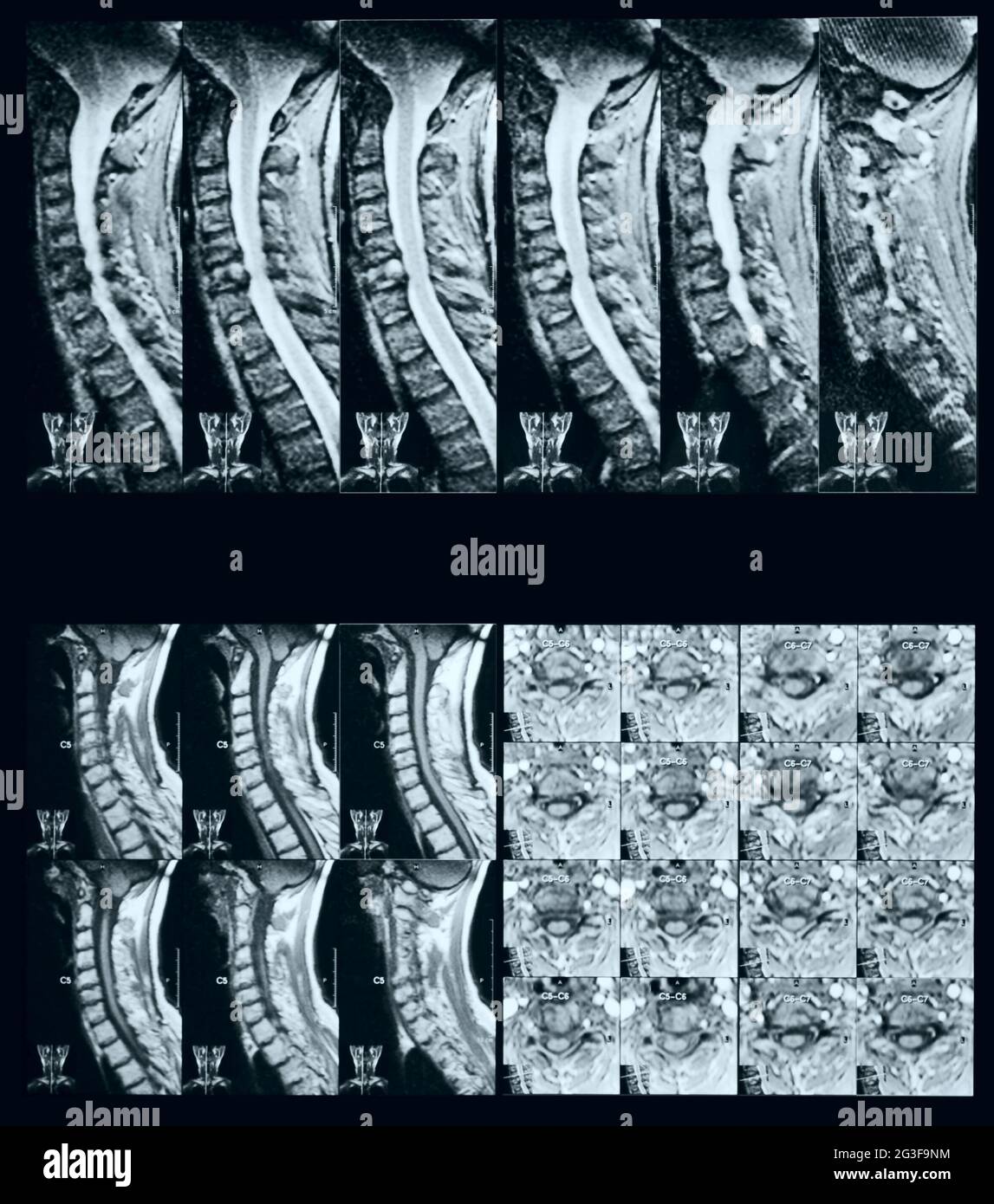 Mrt gehirn -Fotos und -Bildmaterial in hoher Auflösung – Alamy