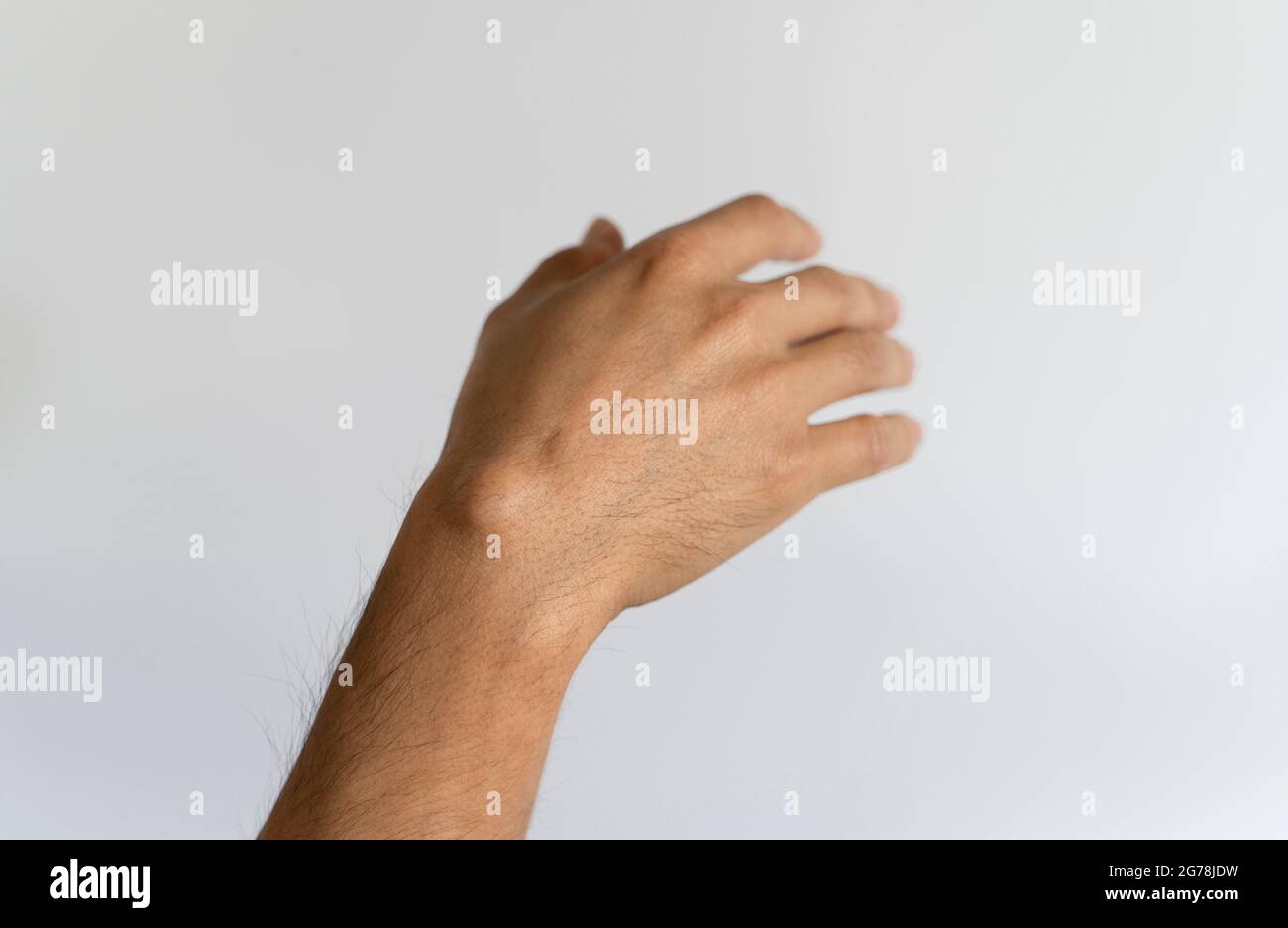 Ganglion cyst -Fotos und -Bildmaterial in hoher Auflösung – Alamy