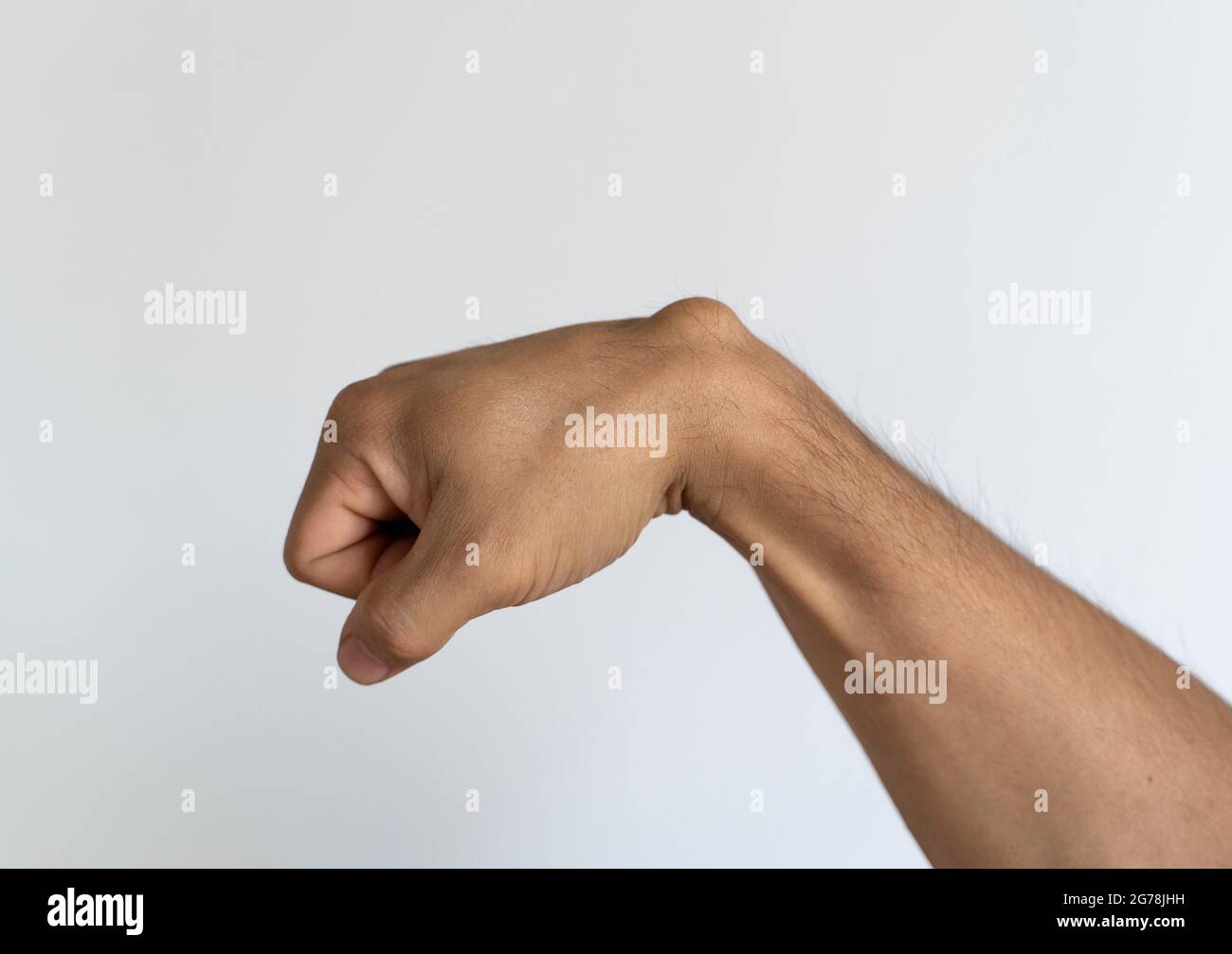 Ganglion cysts -Fotos und -Bildmaterial in hoher Auflösung – Alamy