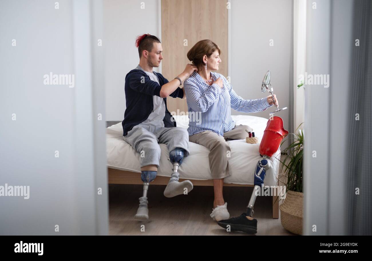 Bein amputierte frau -Fotos und -Bildmaterial in hoher Auflösung – Alamy