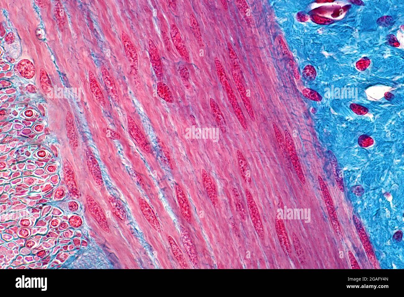 Glatte muskelfaser -Fotos und -Bildmaterial in hoher Auflösung – Alamy
