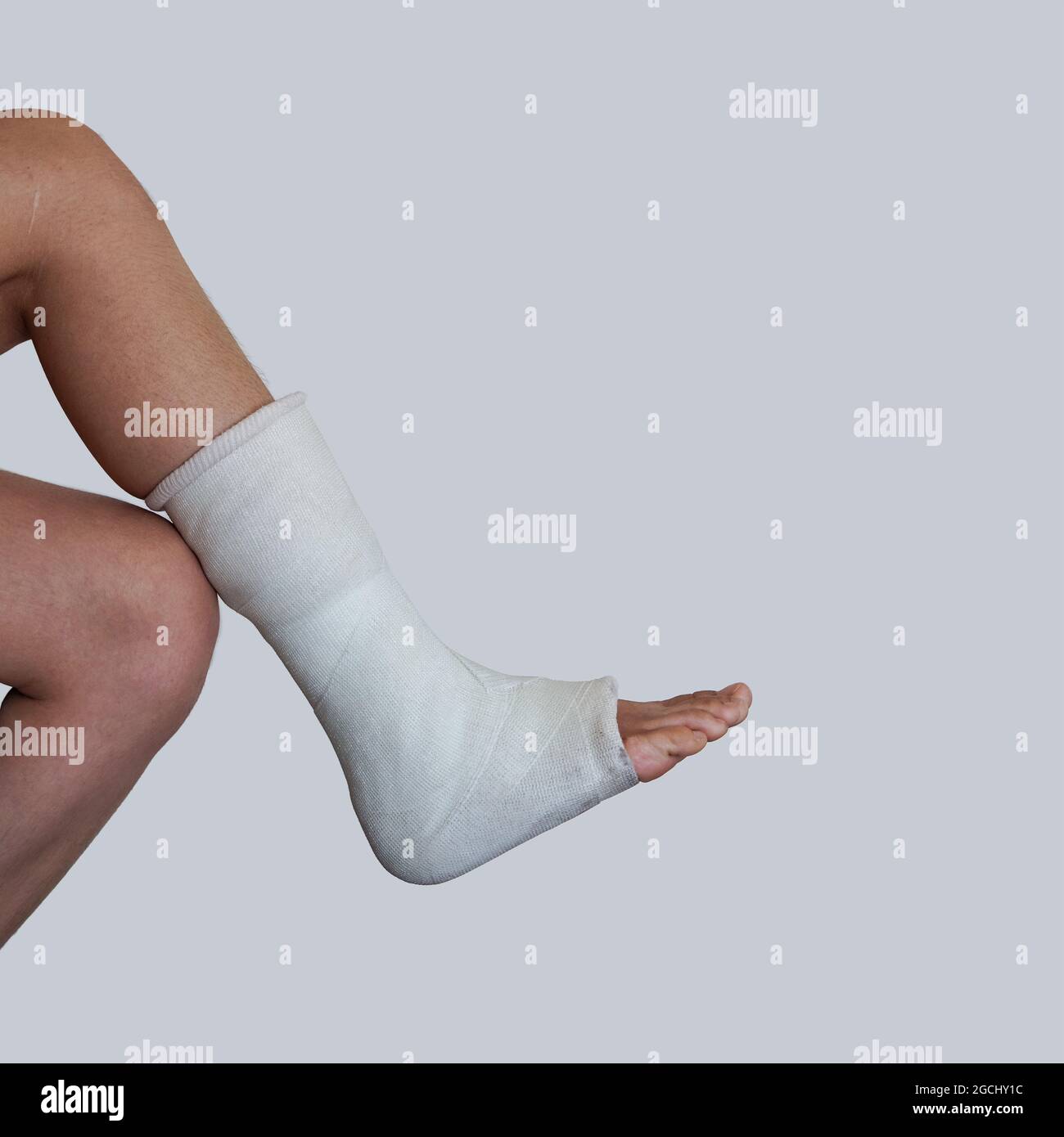 Fuß gebrochen gips -Fotos und -Bildmaterial in hoher Auflösung – Alamy