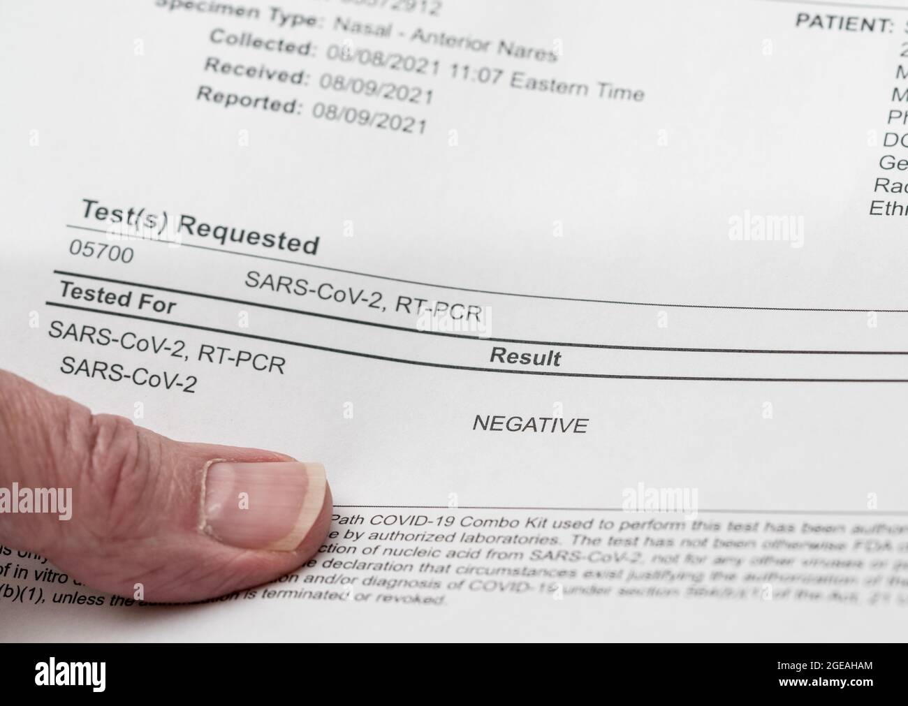 Negatives Pcr Testergebnis Stockfotos und -bilder Kaufen - Alamy
